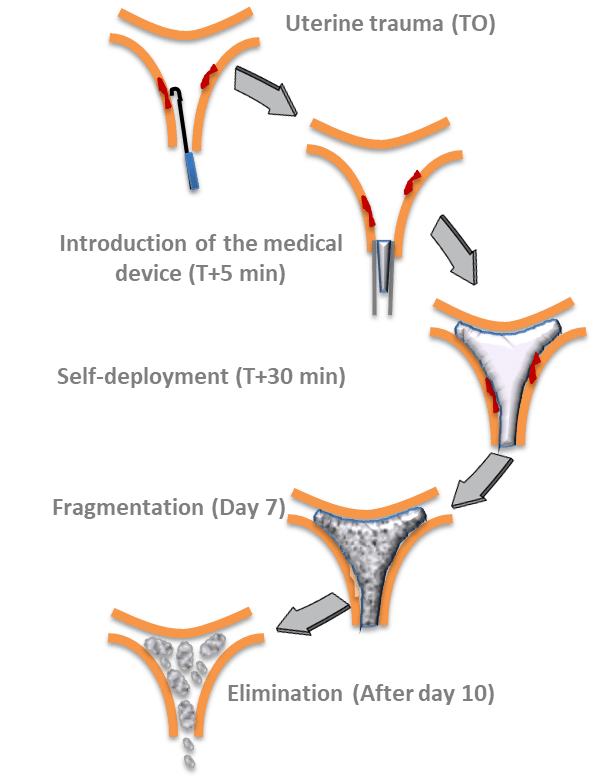 Tissue engineering and medical devices — IBMM Polymers for Health and ...