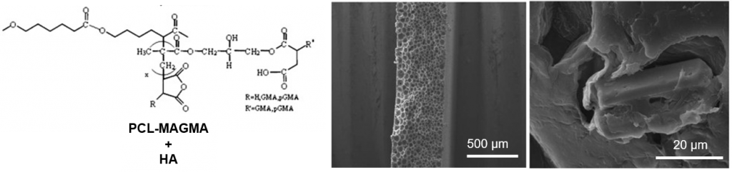 Advanced polymeric biomaterials — IBMM Polymers for Health and Biomaterials