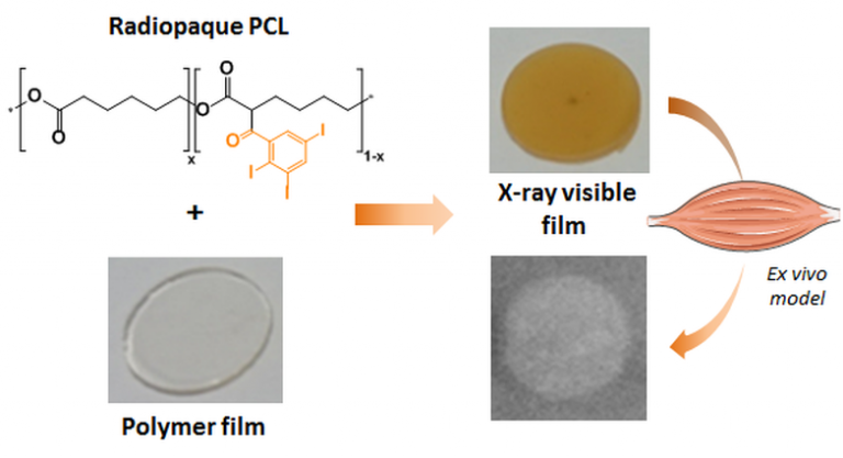 Radiopaque poly(epsilon-caprolactone) as additive for X-ray imaging of ...